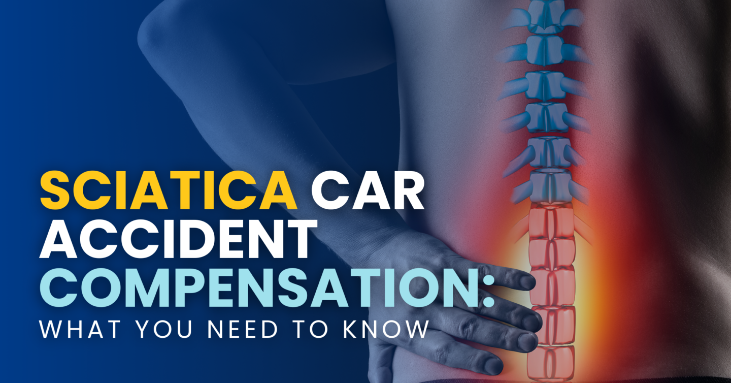 Sciatica Car Accident Compensation: What You Need To Know