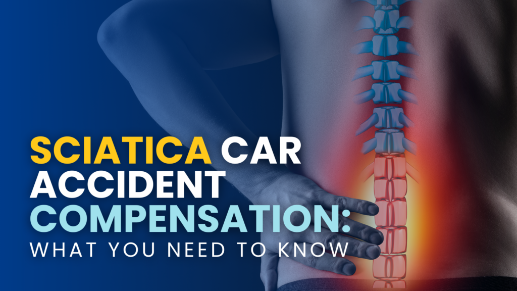 Sciatica Car Accident Compensation: What You Need To Know